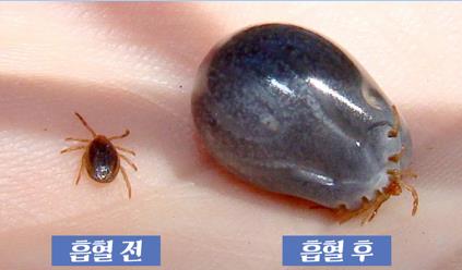 제주 올해 3번째 SFTS 환자 발생…"진드기 주의" | 연합뉴스